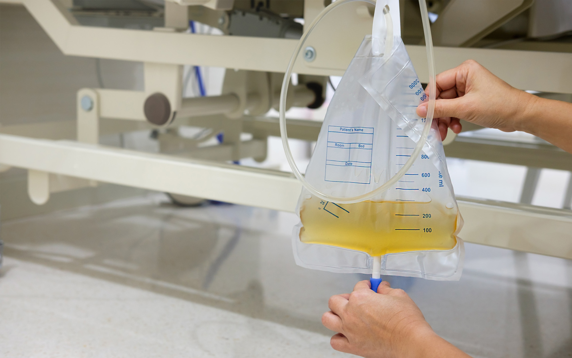 The Hidden Costs of Cheap Medical Drainage Bags | Remington